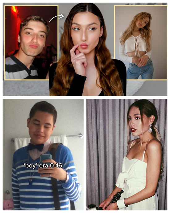 Termos e Procedimentos na Revolução Transgênero